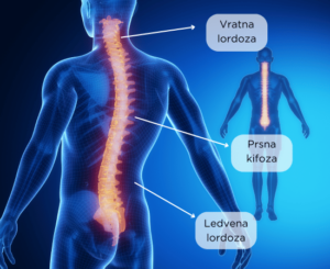 Kaj je ledvena lordoza in ali potrebuje zdravljenje?